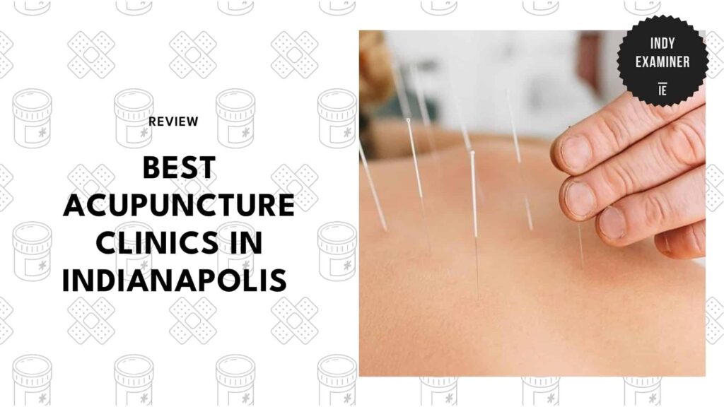 Best Acupuncture Clinics in Indianapolis for Pain Relief [2026 ]